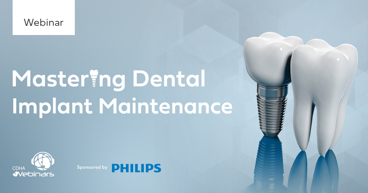 Mastering Dental Implant Maintenance Webinar